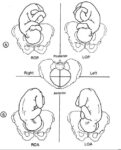 Optimal Fetal Positioning – How2Mom | Birth Support, Online Birthing ...
